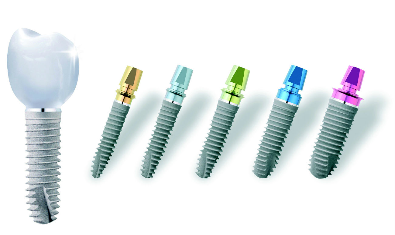 Импланты XiVE – мнения экспертов и особенности системы XiVE.