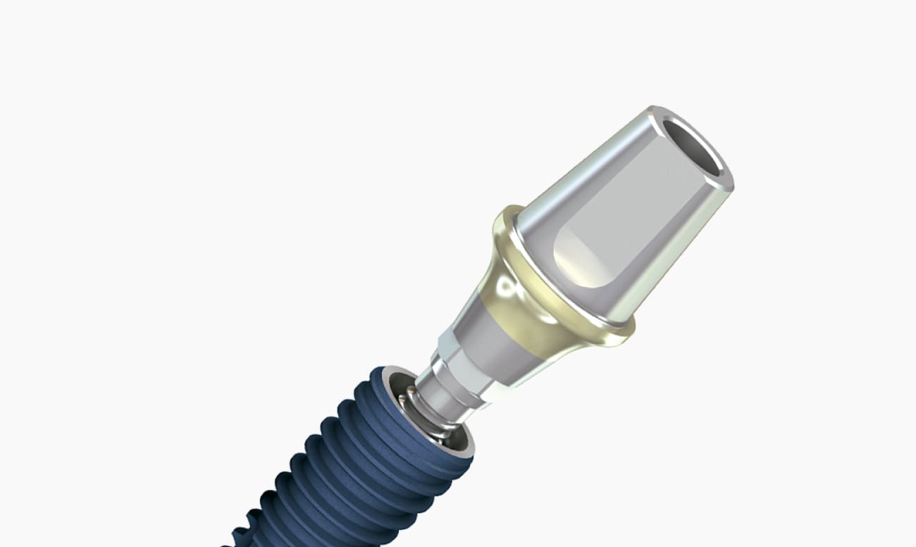 Импланты AnyOne — отзывы, цена, страна производитель зубных имплантов ...