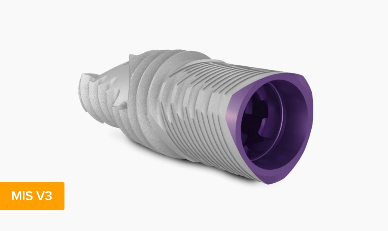 Импланты MIS (Израиль) - преимущества, цена, отзывы стоматологов.