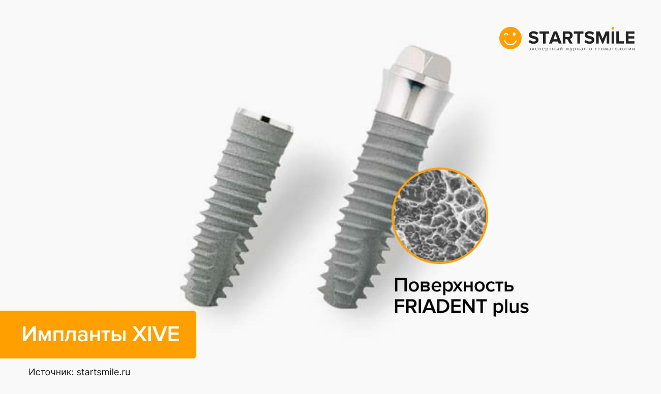 Импланты XiVE – мнения экспертов и особенности системы XiVE.